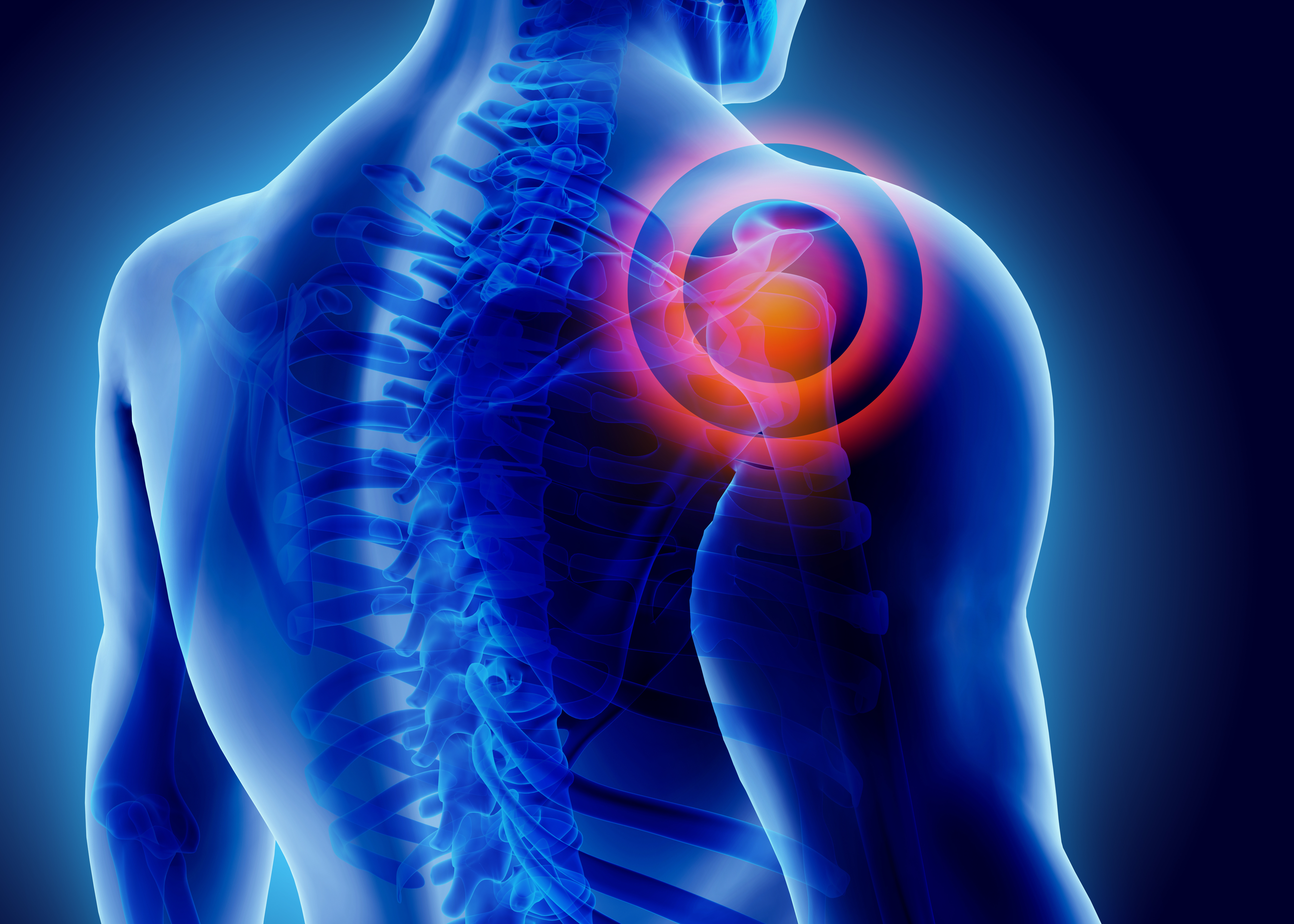 Physical Solutions Signs You May Have A Labrum Tear In Your Shoulder 